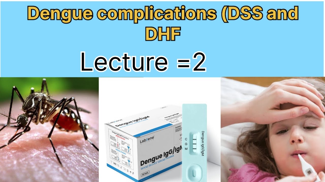 Dengue complications (DSS and DHF )full detail hindi main - YouTube
