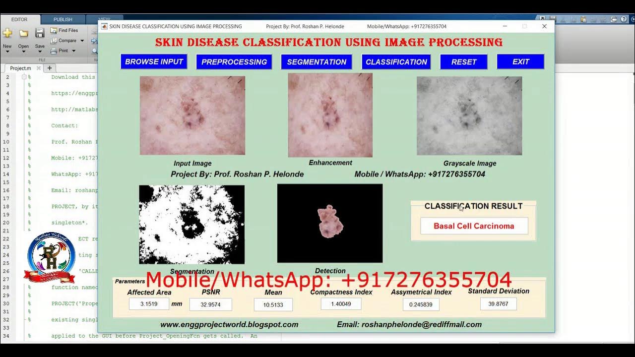 Skin Disease Detection Using Matlab | Skin Disease Classification Using ...