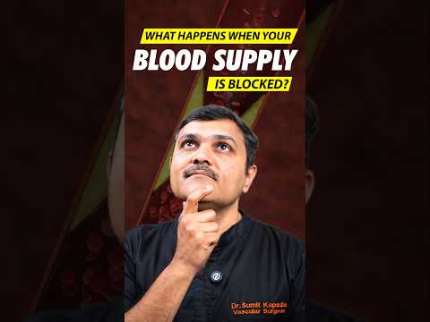 What REALLY Happens When You Have Blocked Arteries