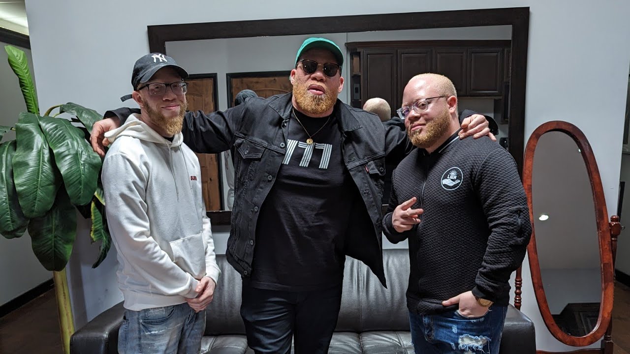 MARVIN KRONDON JONES III TALKS ALBINISM - YouTube