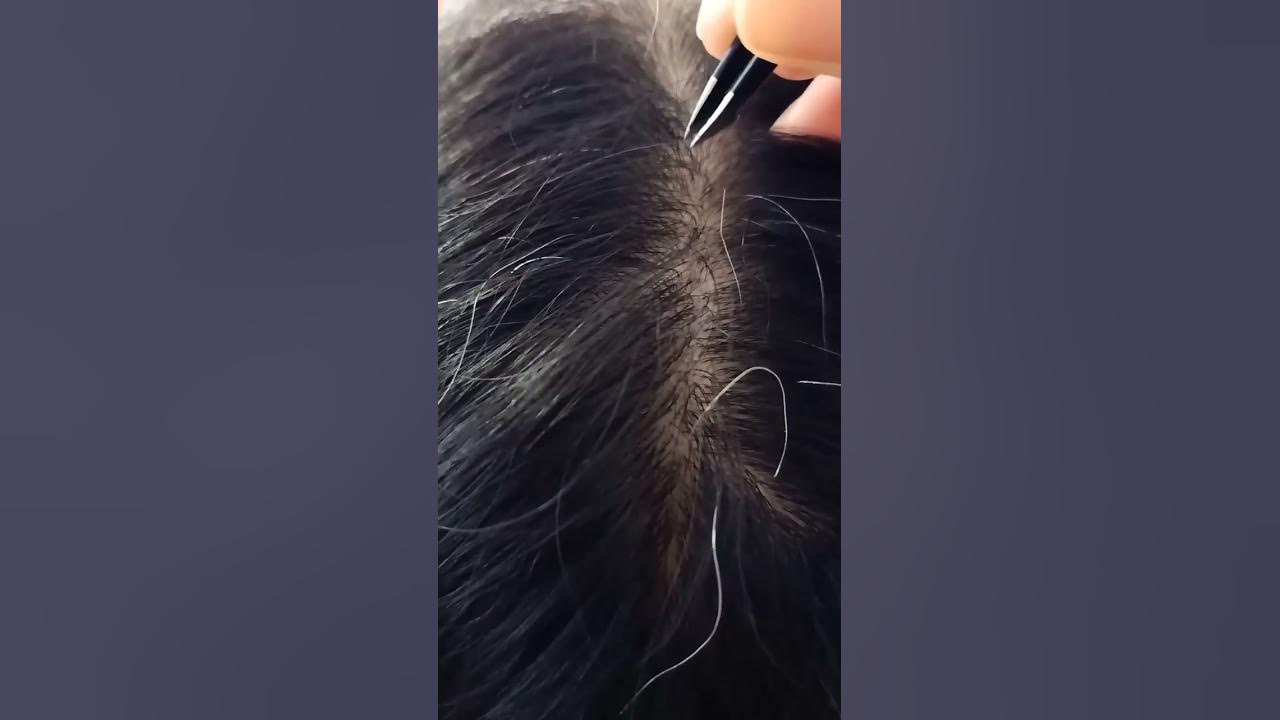 Cabut uban #10 #cabutuban - YouTube