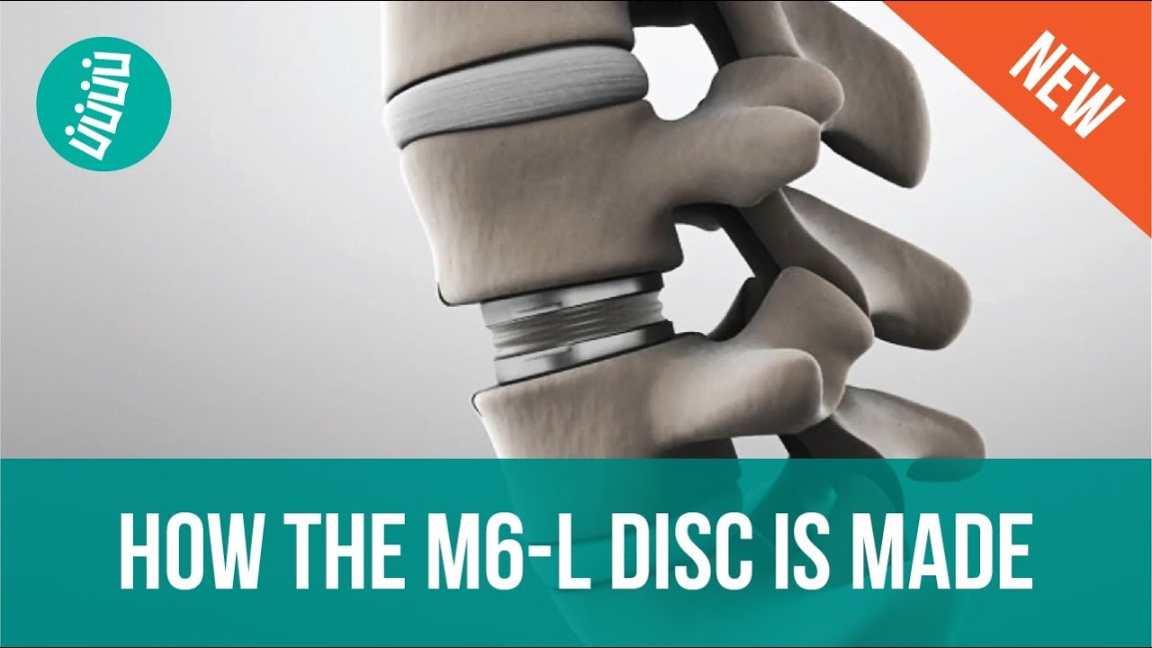M6-L Artificial Disc Replacement (ADR): How it’s Made - YouTube
