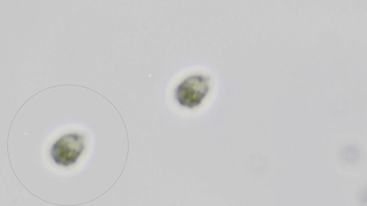 ウロトリカ Urotricha - YouTube