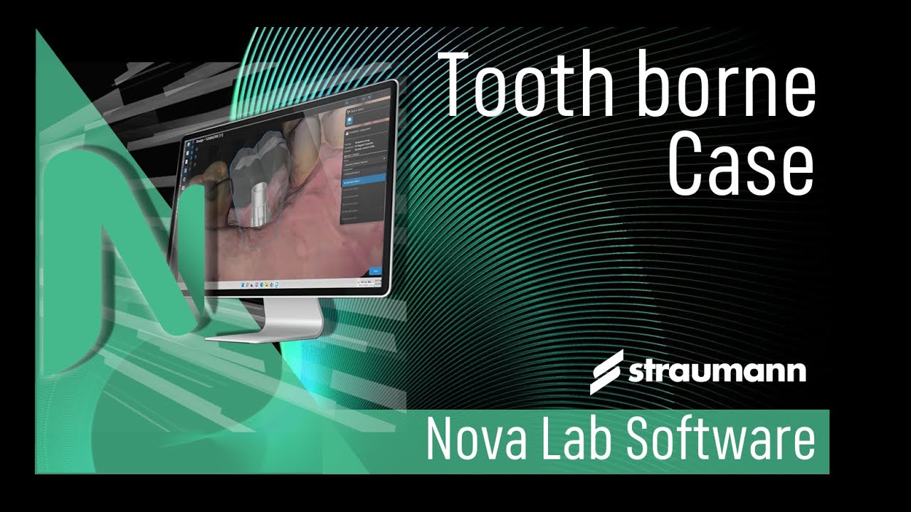 Set up a tooth borne case with Straumann Design Lab Software - YouTube