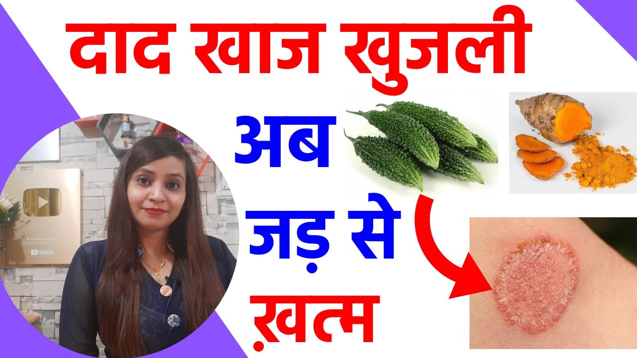 दाद खाज खुजली का घरेलु इलाज | fungal infection ka ilaj | ringworm ...