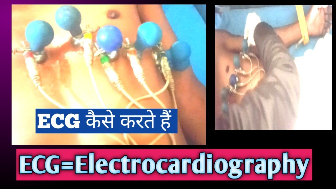 ECG #Electrocardiography is the process || CCG करना सीखें || cardiac ...