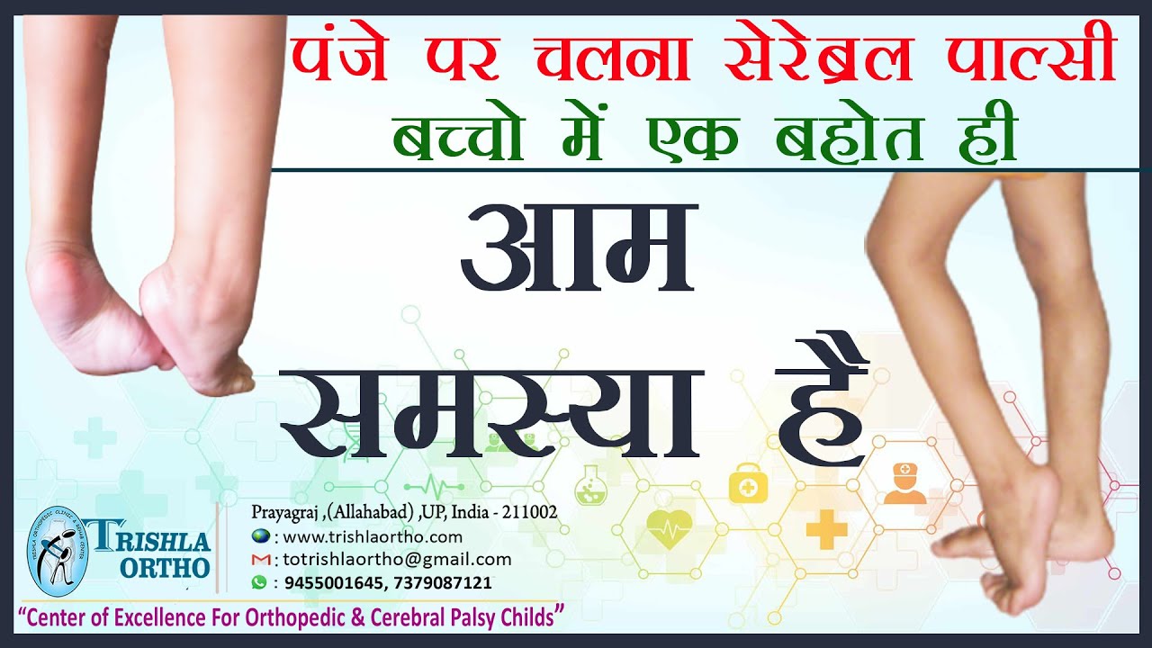 Cerebral Palsy : Equinus Gait - YouTube