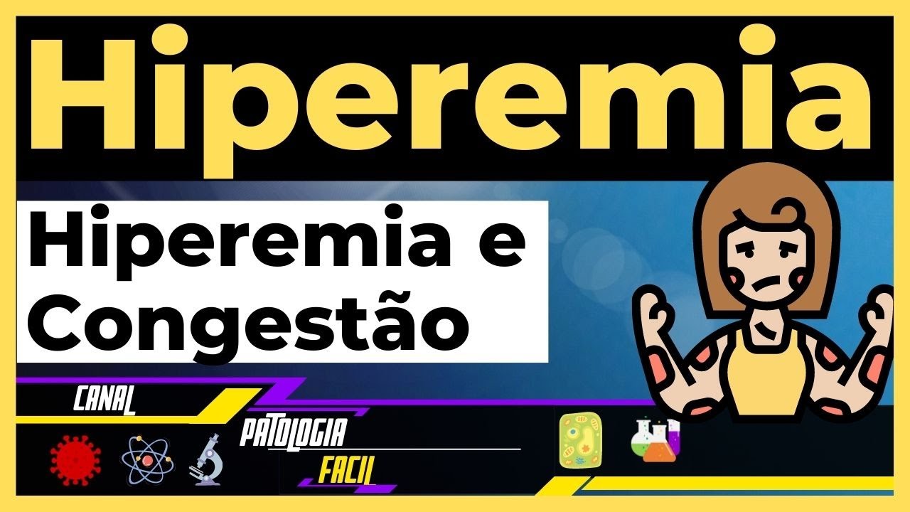 Hiperemia e Congestão - HIPEREMIA ATIVA E PASSIVA - [ATUALIZADO ...