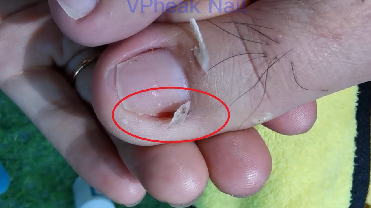 Looks unknowingly has big meat at all | 👣For beauty and toe health - YouTube