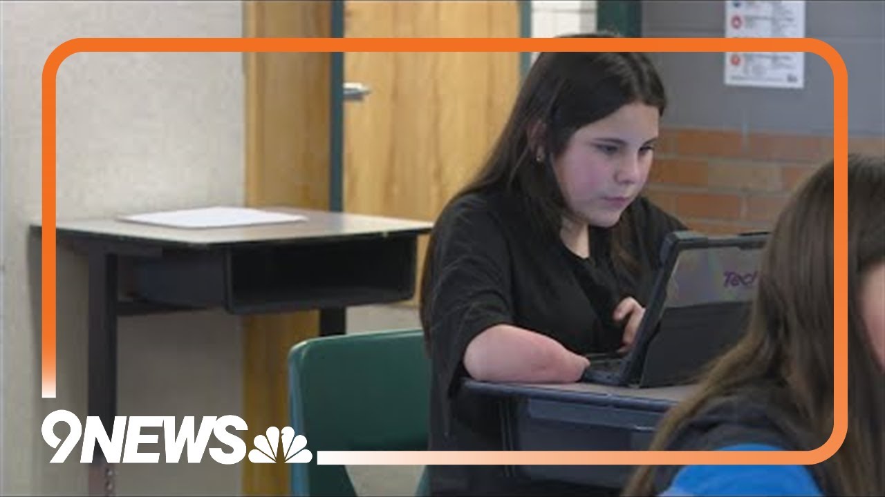 Colorado 10-year-old born without right hand gets prosthetic arm - YouTube