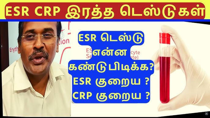 ESR Normal Range In Tamil Erythrocytes Sentimention Rate In, 51% OFF ESR Normal Range In Tamil Erythrocytes Sentimention Rate In, 51% OFF