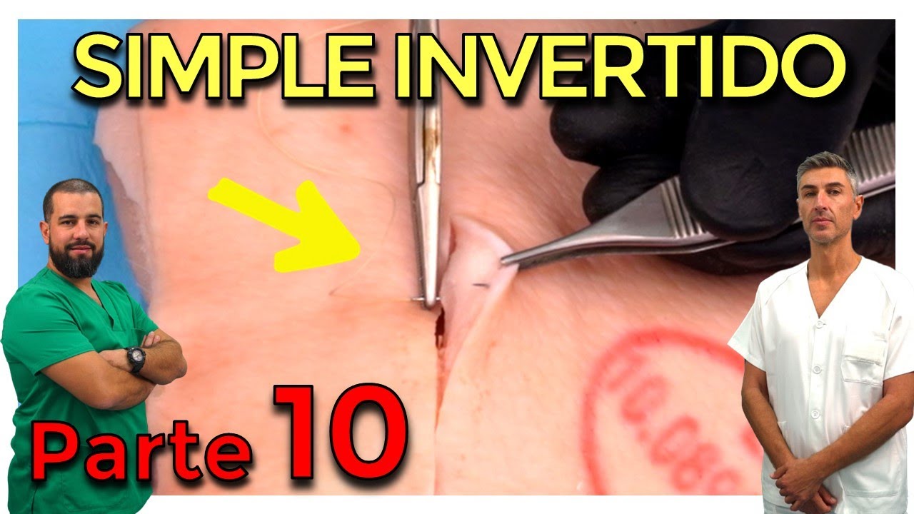 PUNTO INTERNO o SIMPLE INVERTIDO – CIRUGÍA MENOR y SUTURAS (Parte 10 ...
