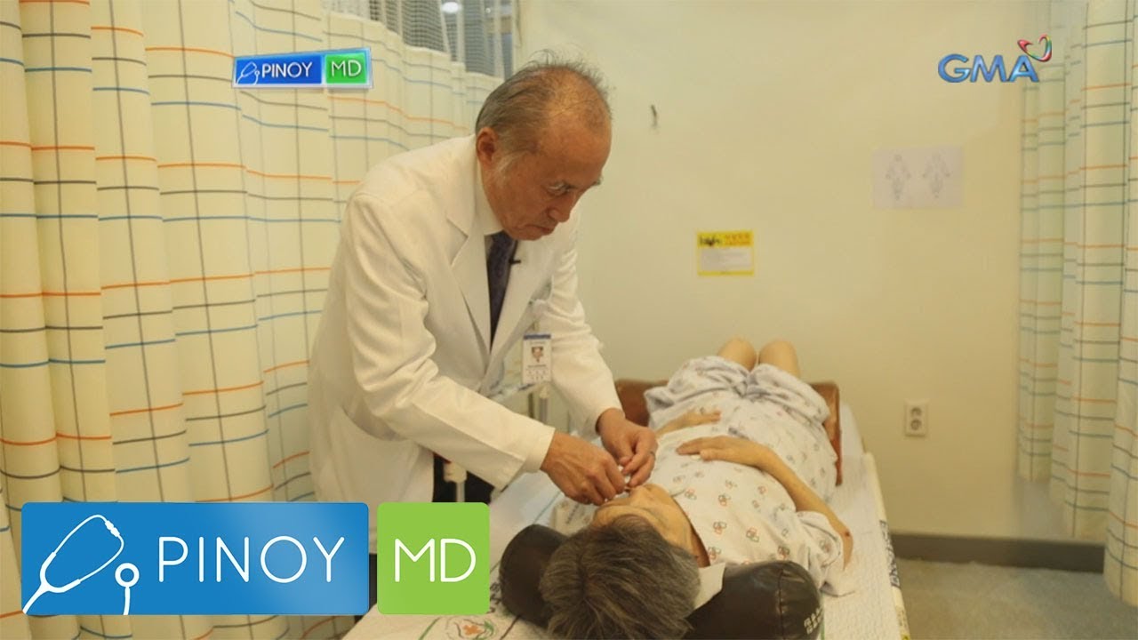 Pinoy MD: Korea's traditional acupuncture, itinampok sa ‘Pinoy MD ...