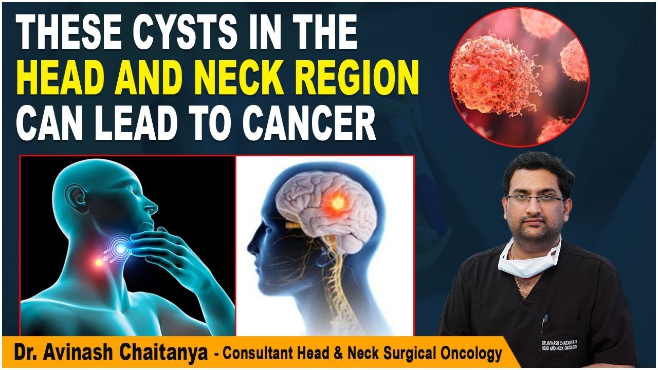 How to Detect Head and Neck Cancer? || Head and Neck Cancer Symptoms ...
