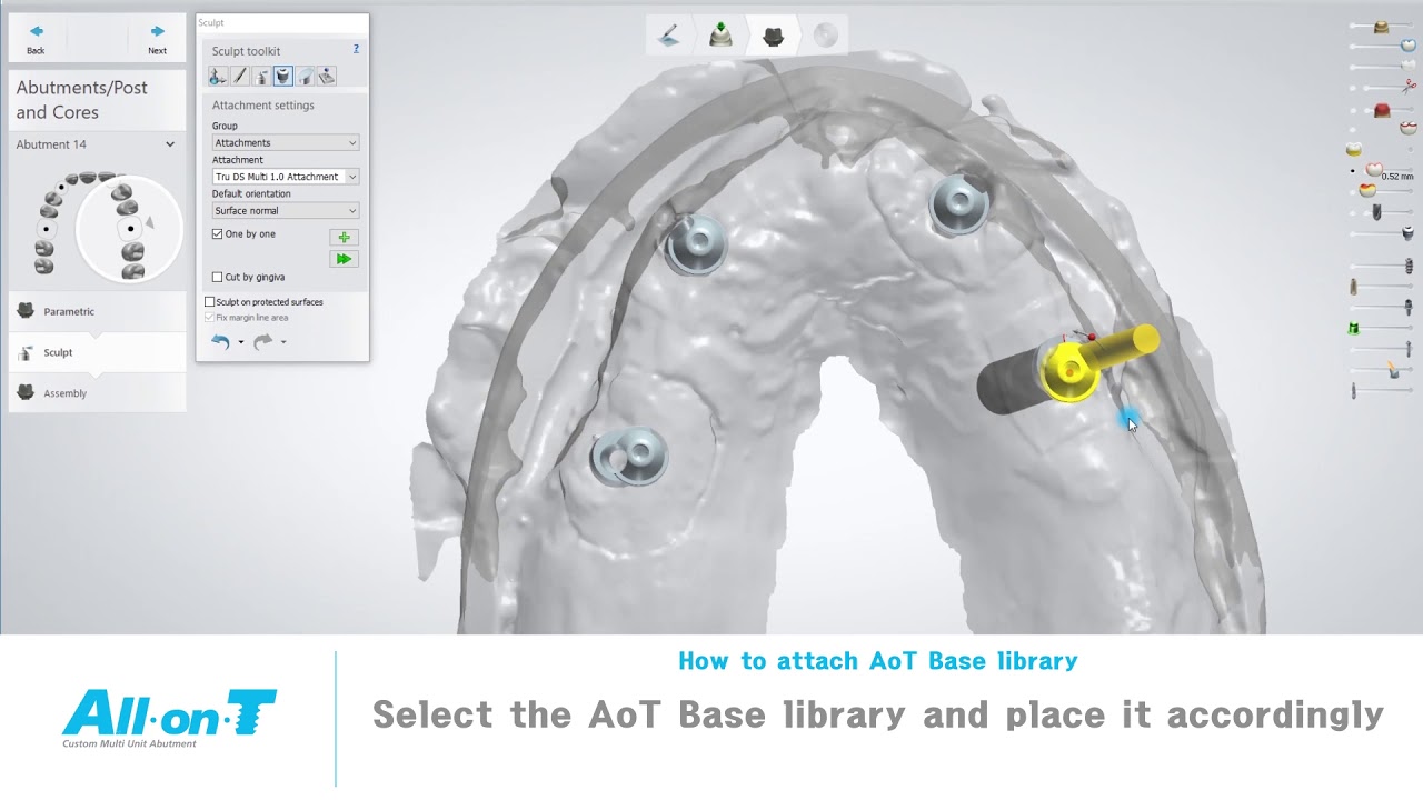 All on T Design_3shape - YouTube