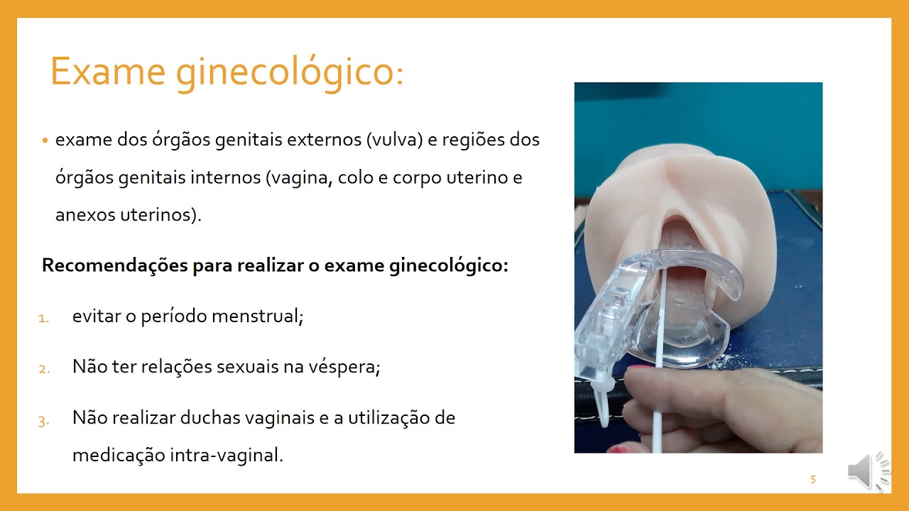 ROTEIRO PARA EXAME GINECOLOGICO. - YouTube