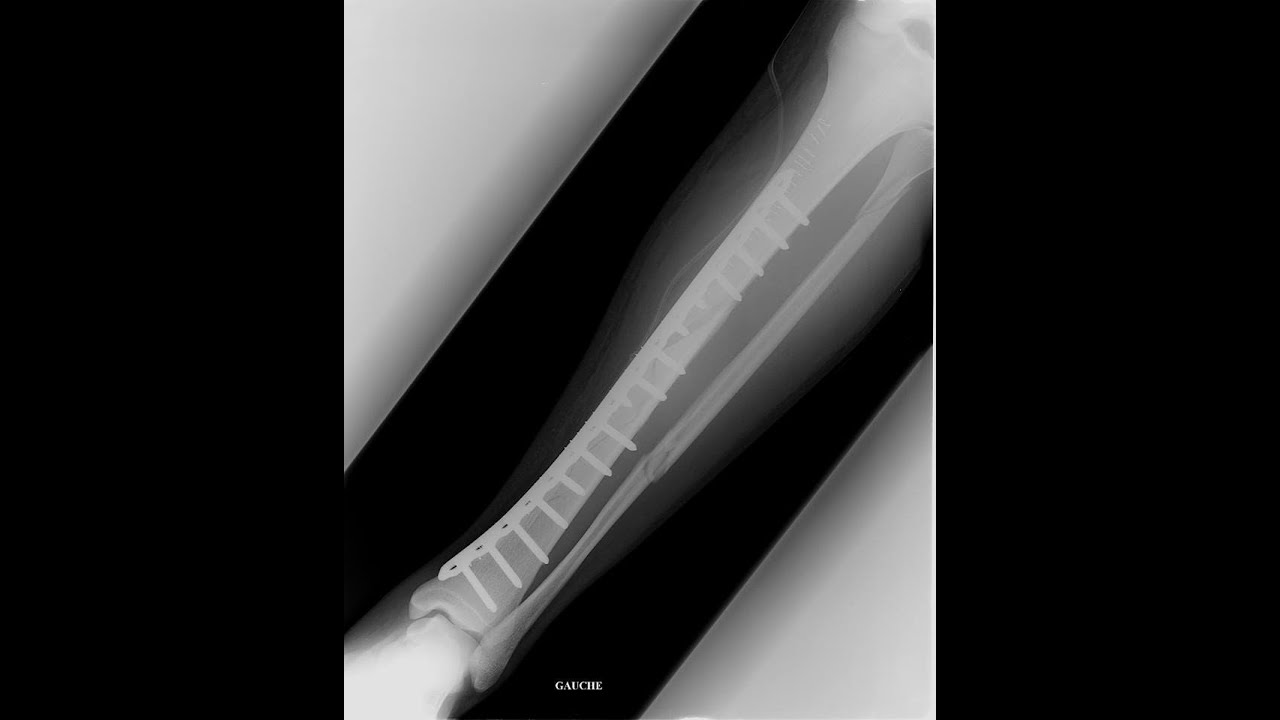 Why Din settings are important.. - YouTube