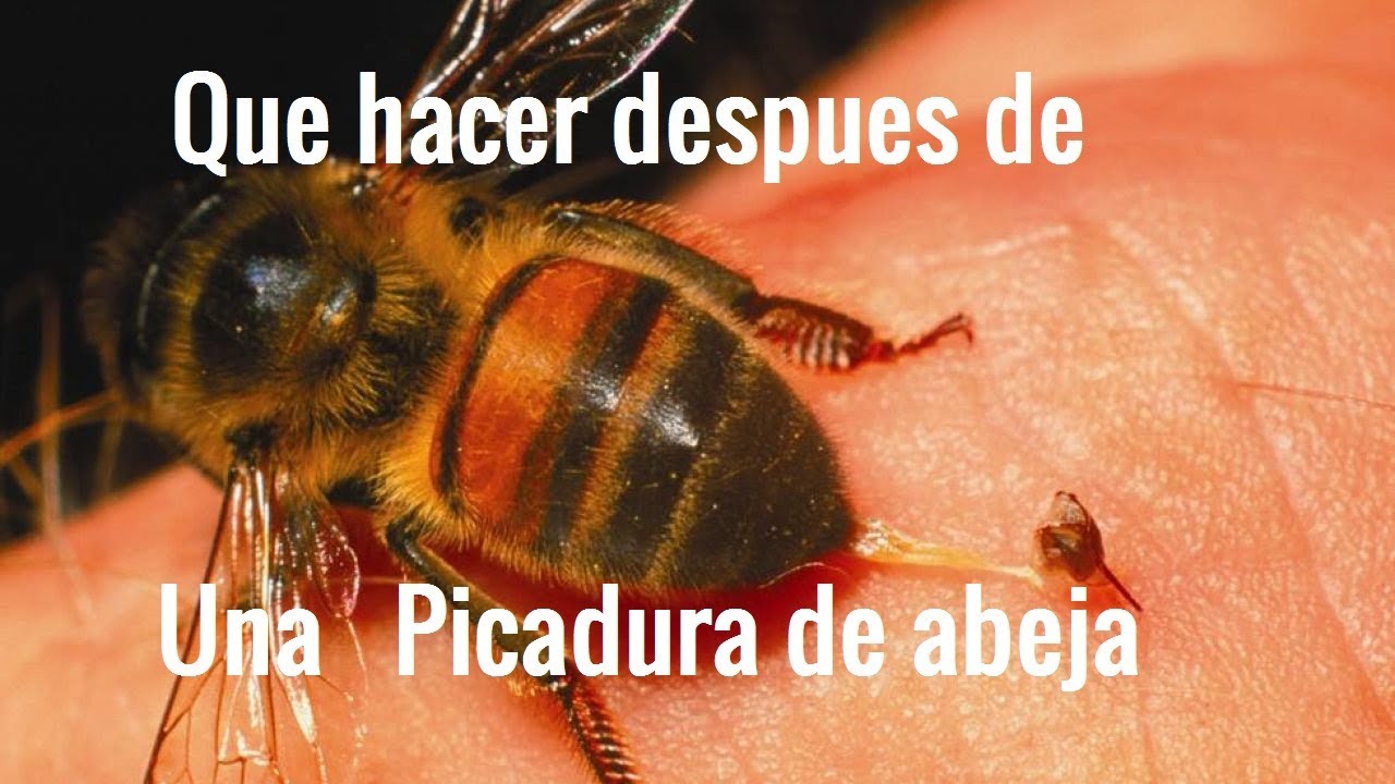que hacer despues de una picadura de abeja - YouTube
