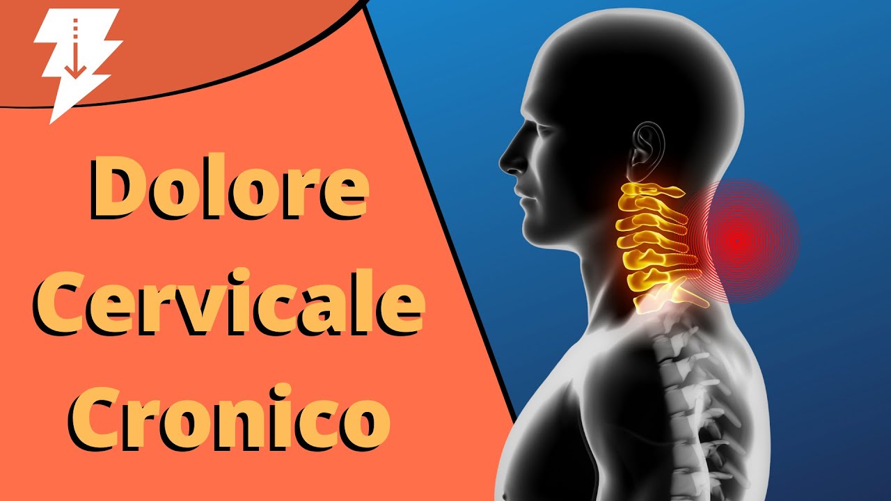 Dolore cervicale cronico | Come risolvere DEFINITIVAMENTE - YouTube