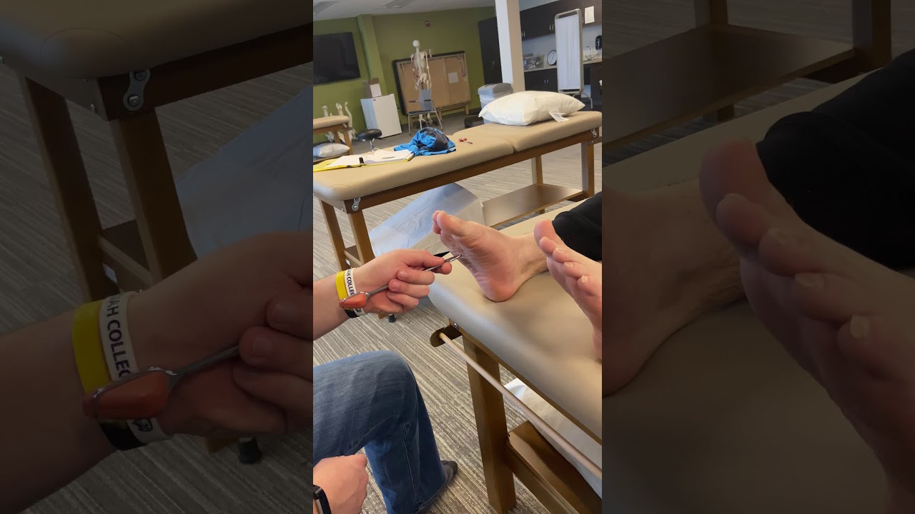 Pathological Reflex: Babinski Sign - YouTube