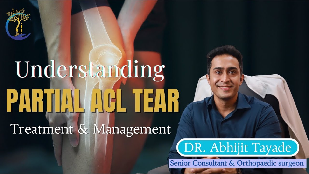 Partial ACL Tear : Do You Really Need Surgery? | Dr. Abhijit Tayade ...