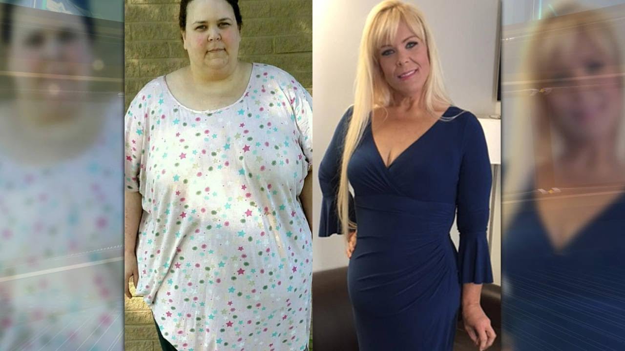 ‘I’m Having Trouble Connecting With Who I Am Now,’ Says Woman After 300 ...