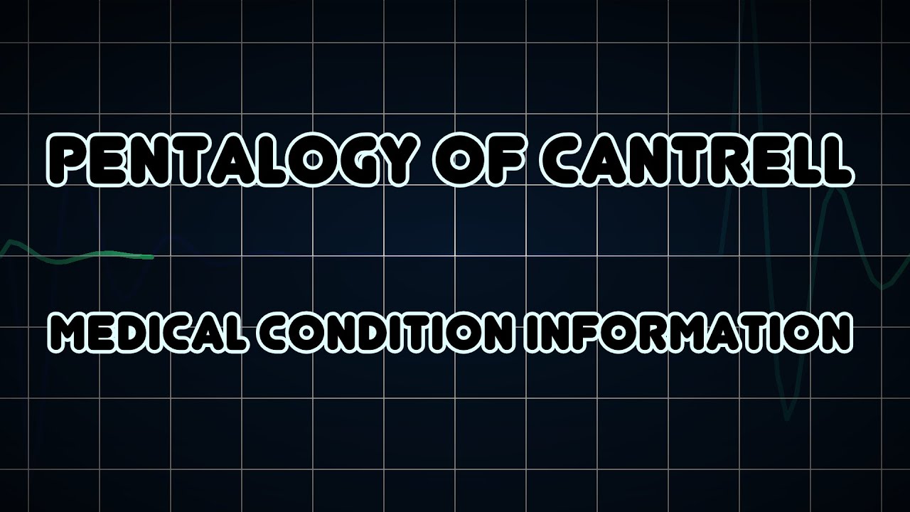 Pentalogy of Cantrell (Medical Condition) - YouTube