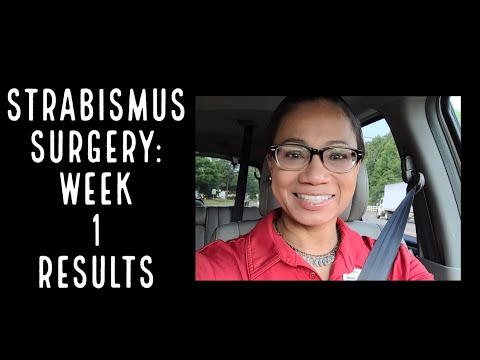 Week 1 Results after bilateral strabismus surgery! - YouTube