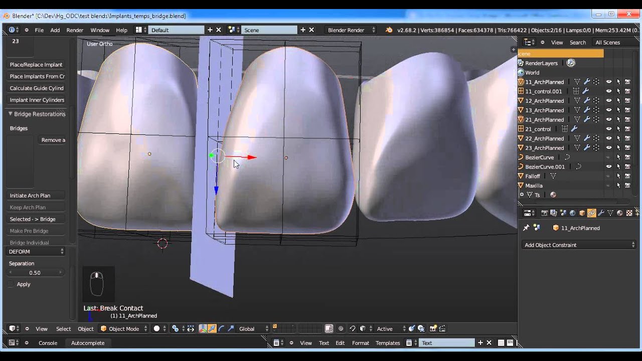 New Splint Guide Temporary Bridge etc - YouTube