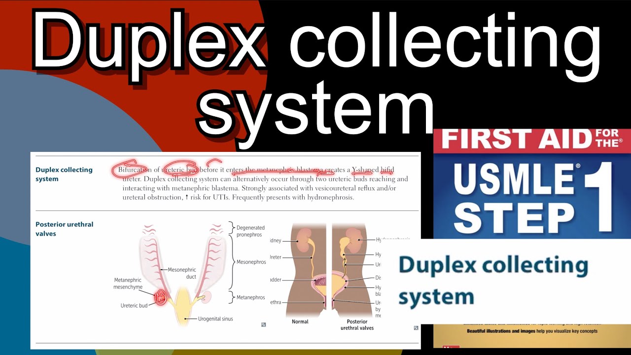 Duplex collecting system in Hindi/Urdu by first aid for USMLE step 1 ...