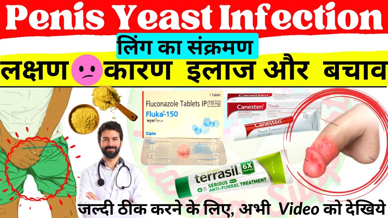 how to treat penile yeast infection | fungal penis infection | genital ...