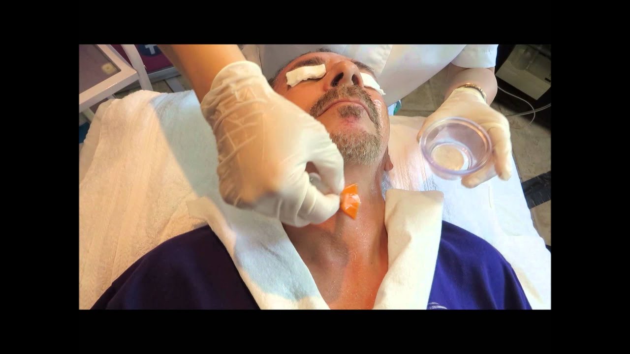 Virtual Mesotherapy ,Electroporation treatment - YouTube