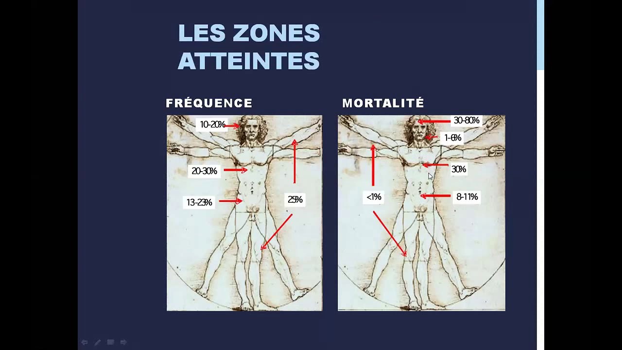 les blessures en médecine légale ( médecine légale - médecine sociale ...