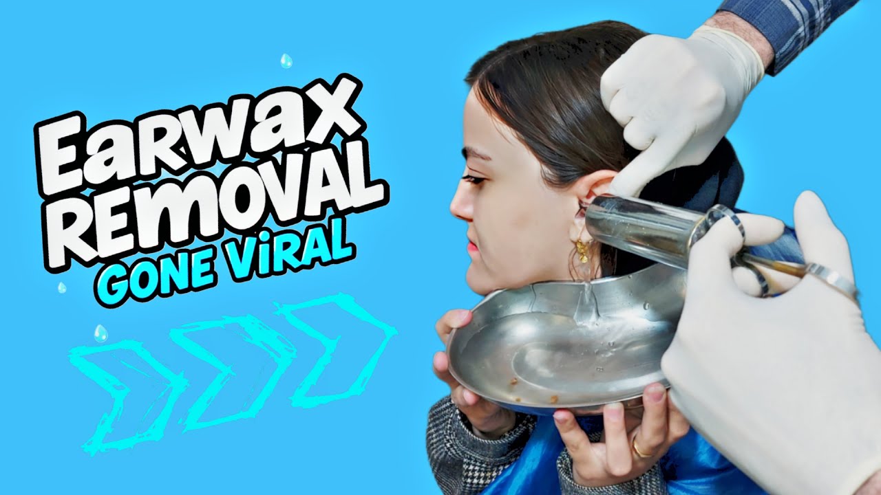 Ear Wax Removal Gone VIRAL | Ear Wax Removal for girl #earwaxremoval # ...