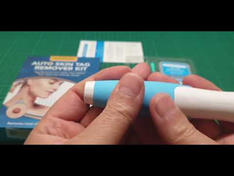 Auto Skin tag remover kit | updated large & small tags review