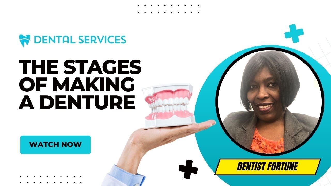 DO YOU KNOW THE STAGES OF MAKING A DENTURE 2024? | DENTIST FORTUNE ...