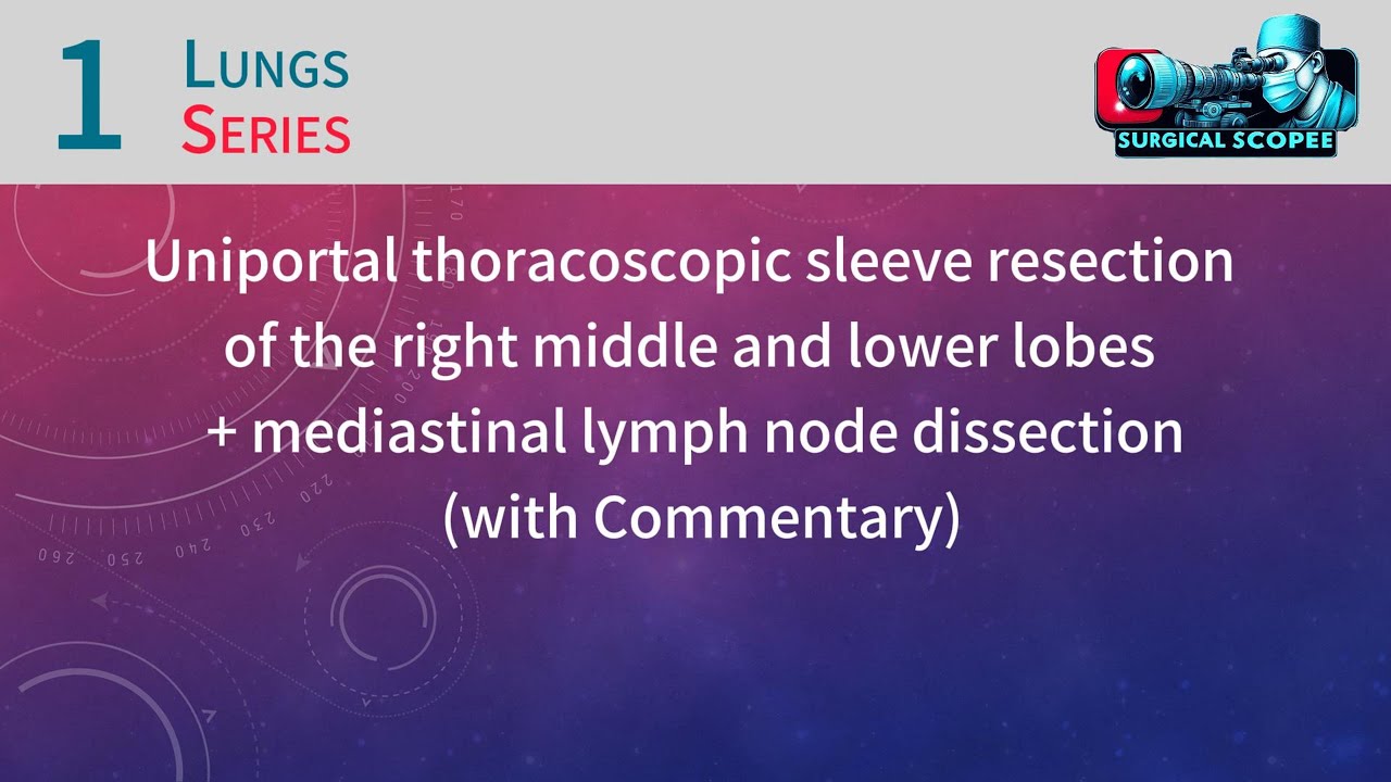 Uniportal thoracoscopic sleeve resection of the right middle and lower ...