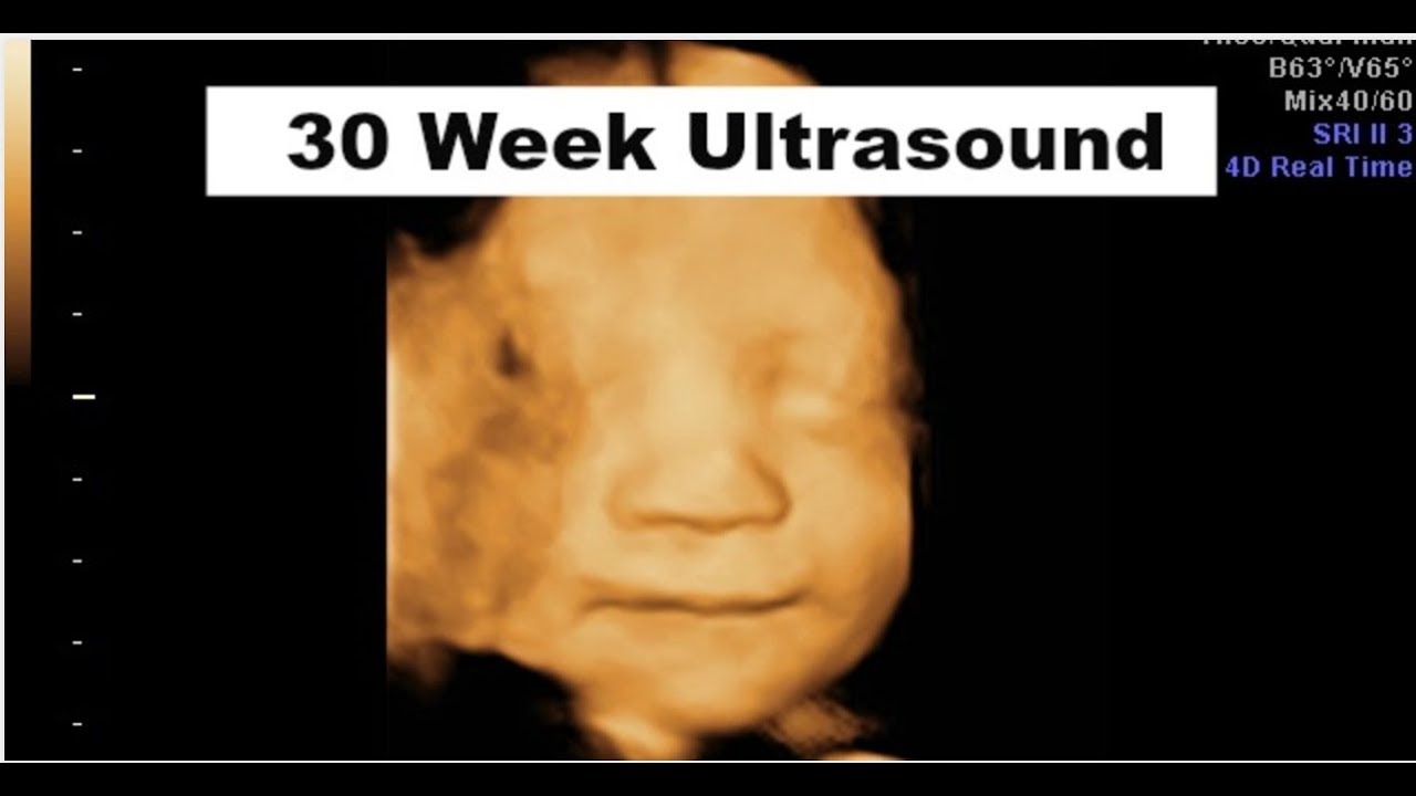 Pregnancy Vlog: 30 Week Ultrasound - YouTube