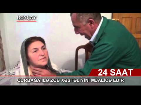 Göyçaylı həkim qurbağa ilə zob xəstəliyini müalicə edir