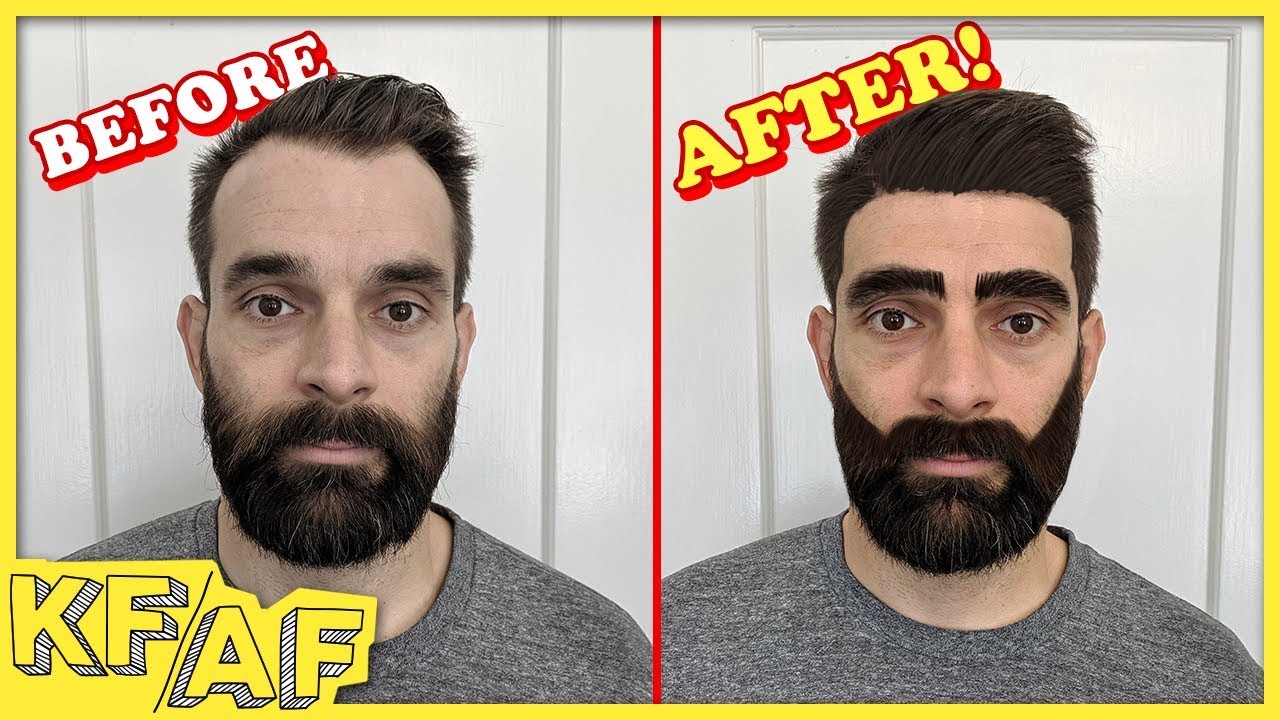 How to Cure Baldness - KF/AF - YouTube