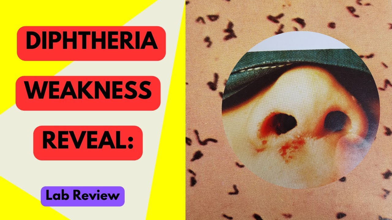 DIPHTHERIA WEAKNESSES REVEALED: LAB REVIEW - YouTube