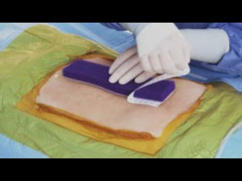 3M™ Prevena™ Therapy Tips and Tricks Video Colorectal - YouTube