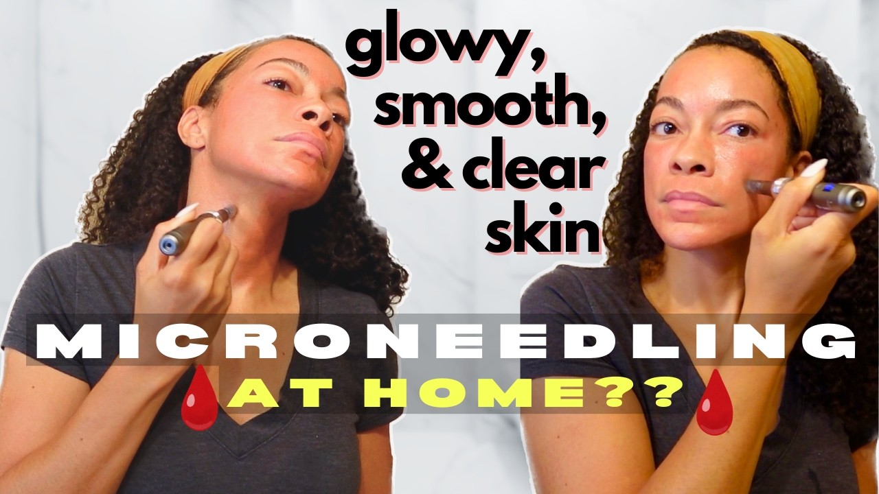 How I use MICRONEEDLING AT Home | FACE & NECK | DIY - YouTube