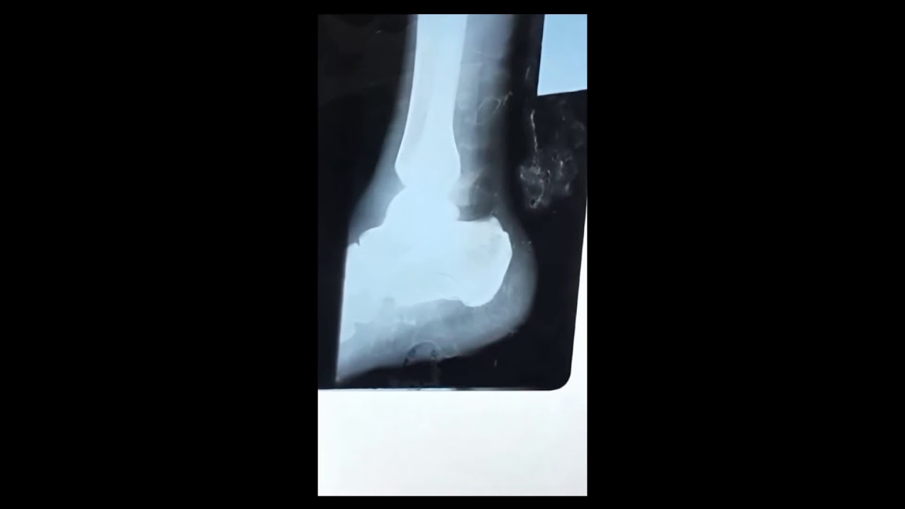 Practical Forensic X ray Part 3 - YouTube