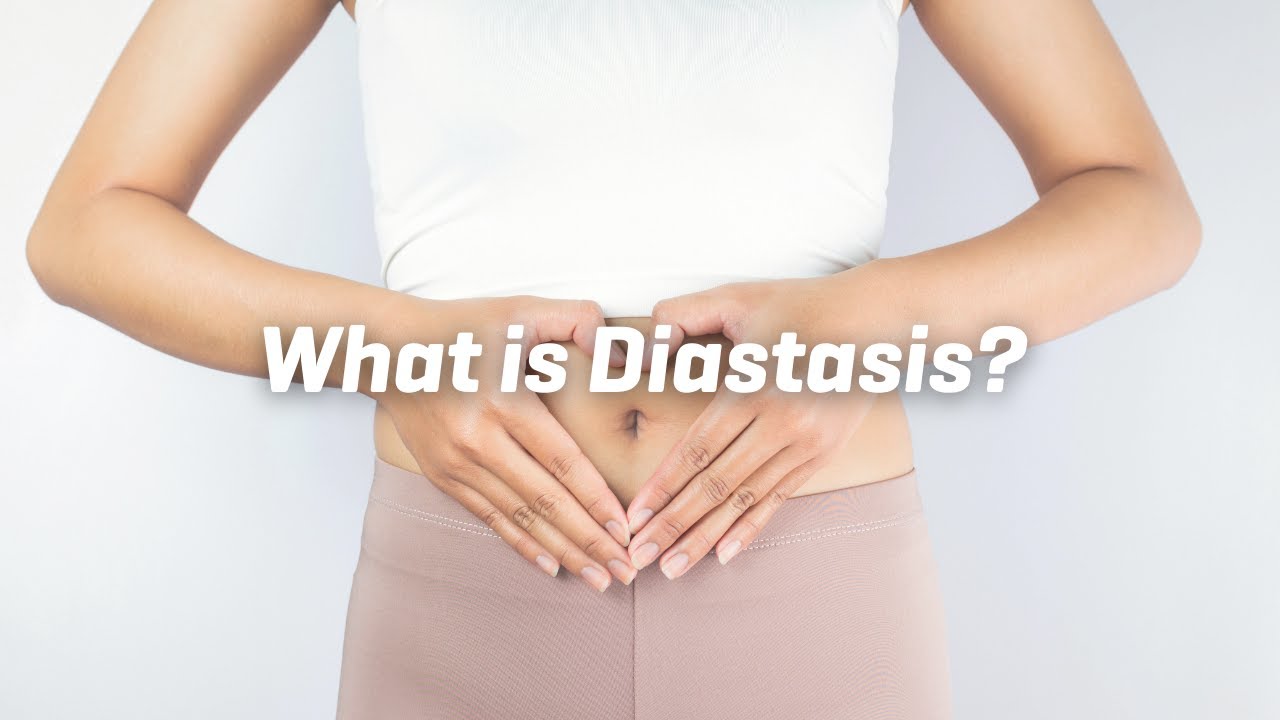 What is Diastasis? - YouTube