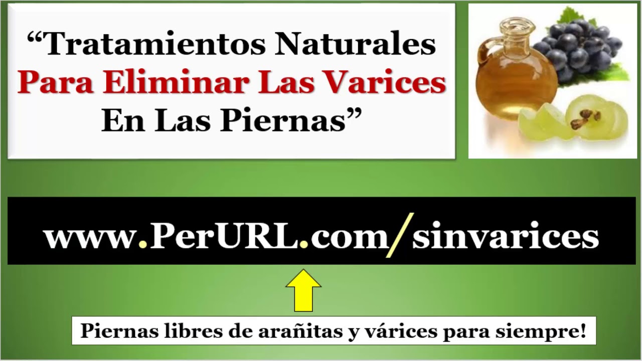 Como eliminar las varices de forma natural para siempre con remedios ...
