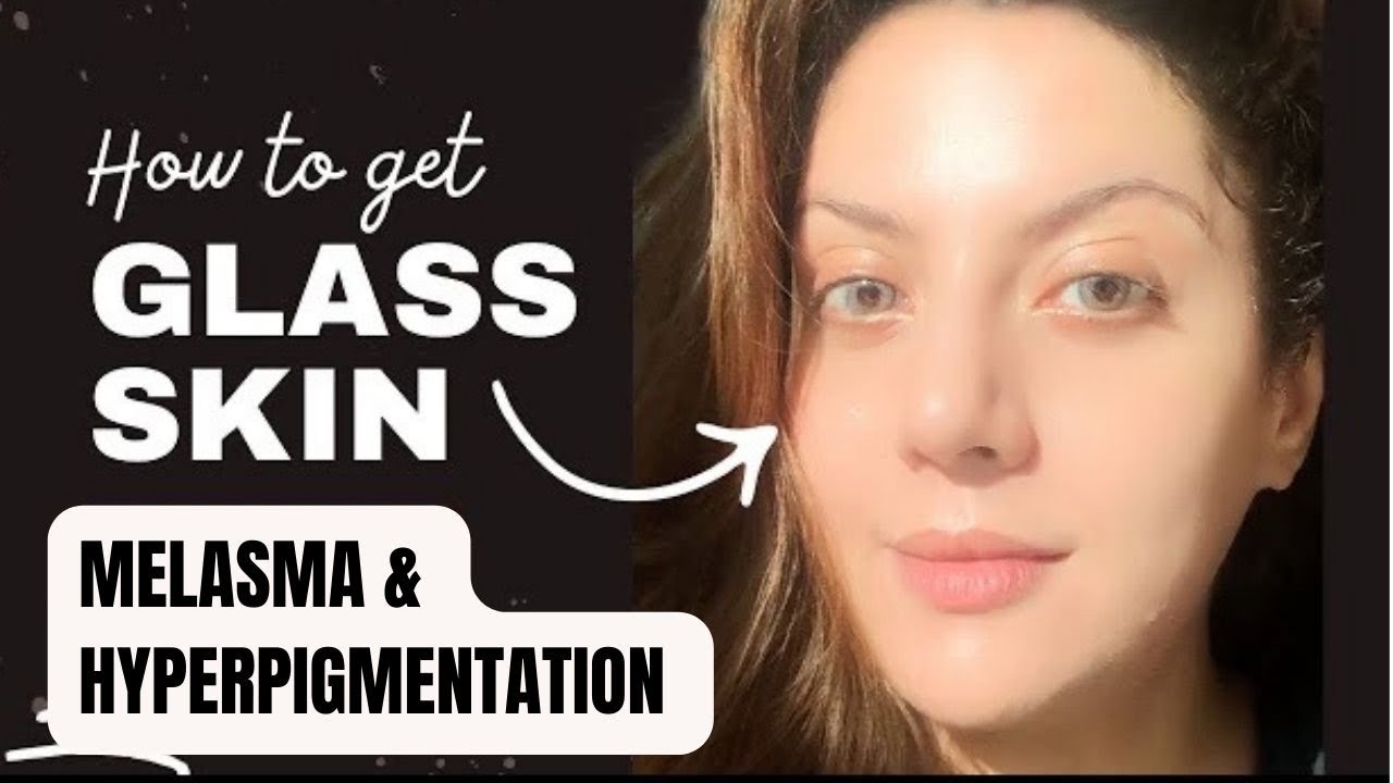 Melasma Removal at Home I Melasma Remove cream I Melasma Skin Care ...