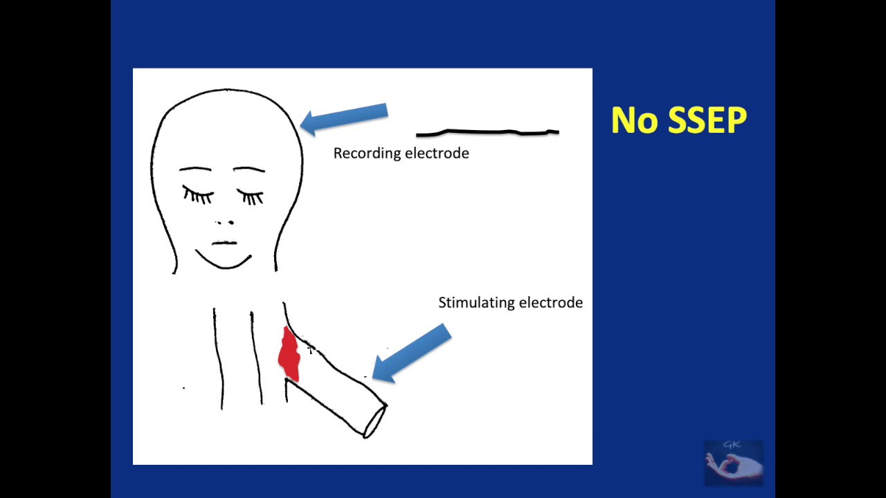 BPI Investigations and interpretation - YouTube