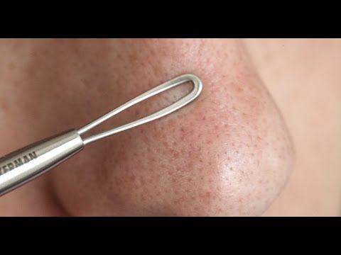 Палочка для удаления черных точек купить - YouTube