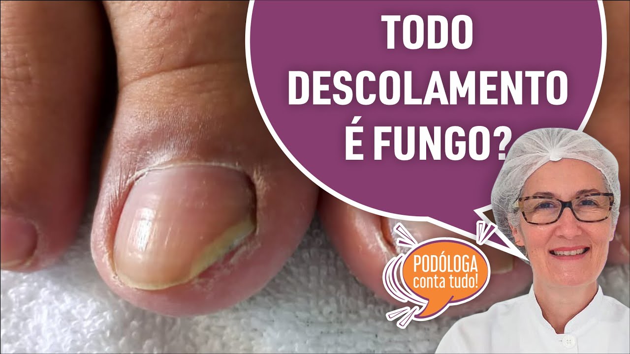 Unha Oca Deve Ser Cortada - RETOEDU